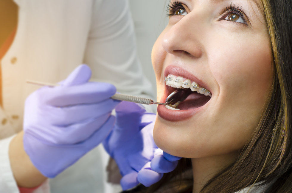 Types of Dental Braces Guide | Billings MT Orthodontist