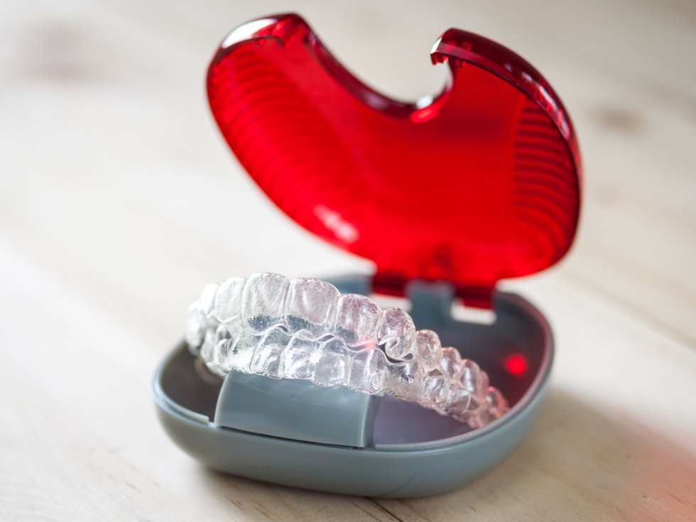 How to Get Invisalign: Step-by-Step Guide