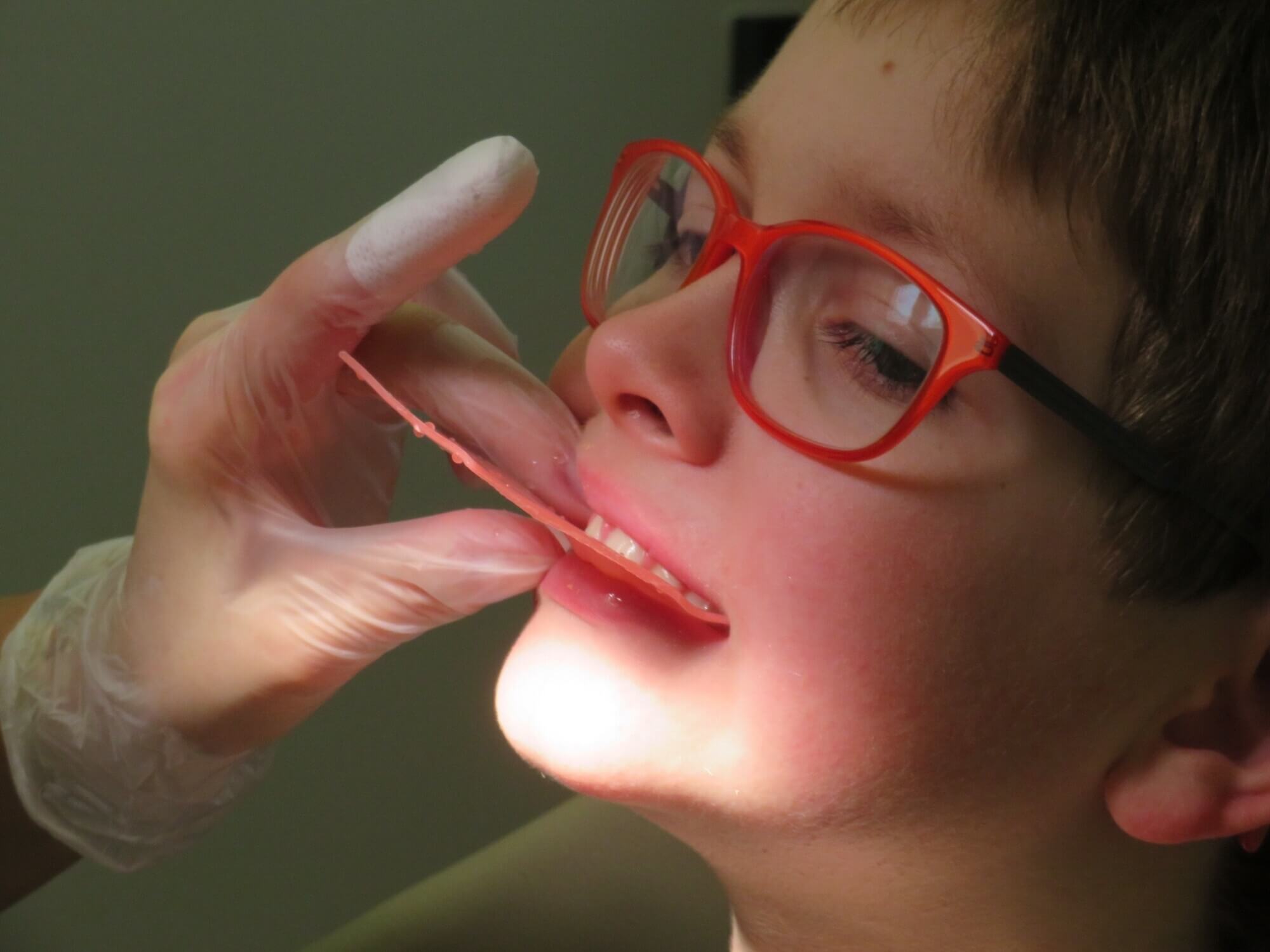 Child Braces: When Your Kid’s Teeth Need Help